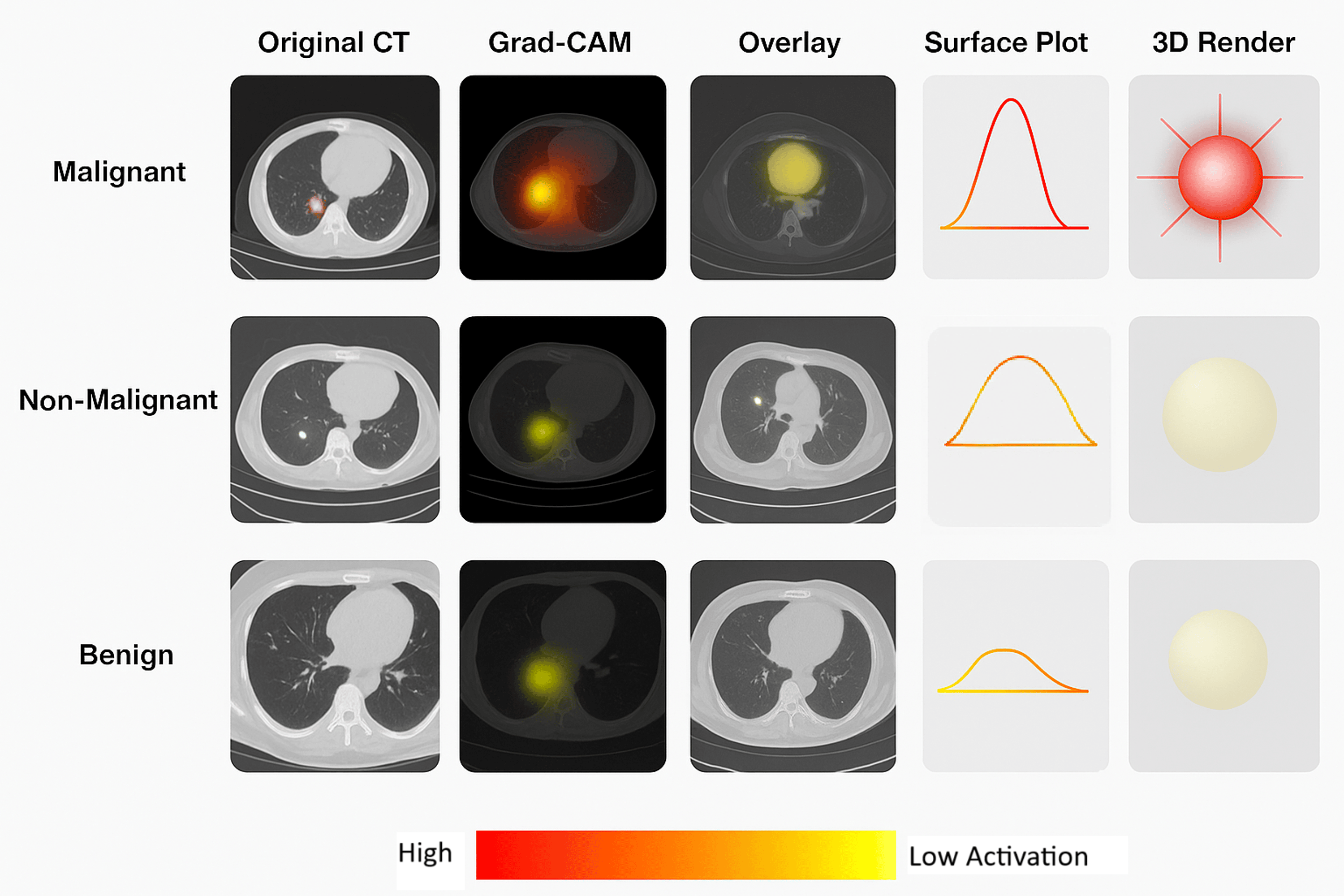Timely Detection of Lung Nodule Malignancy Using 3D Convolutional ...