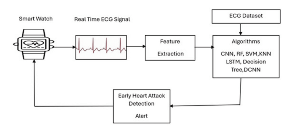 Early Heart Attack Detection Using Real-Time ECG Signals: A Systematic ...